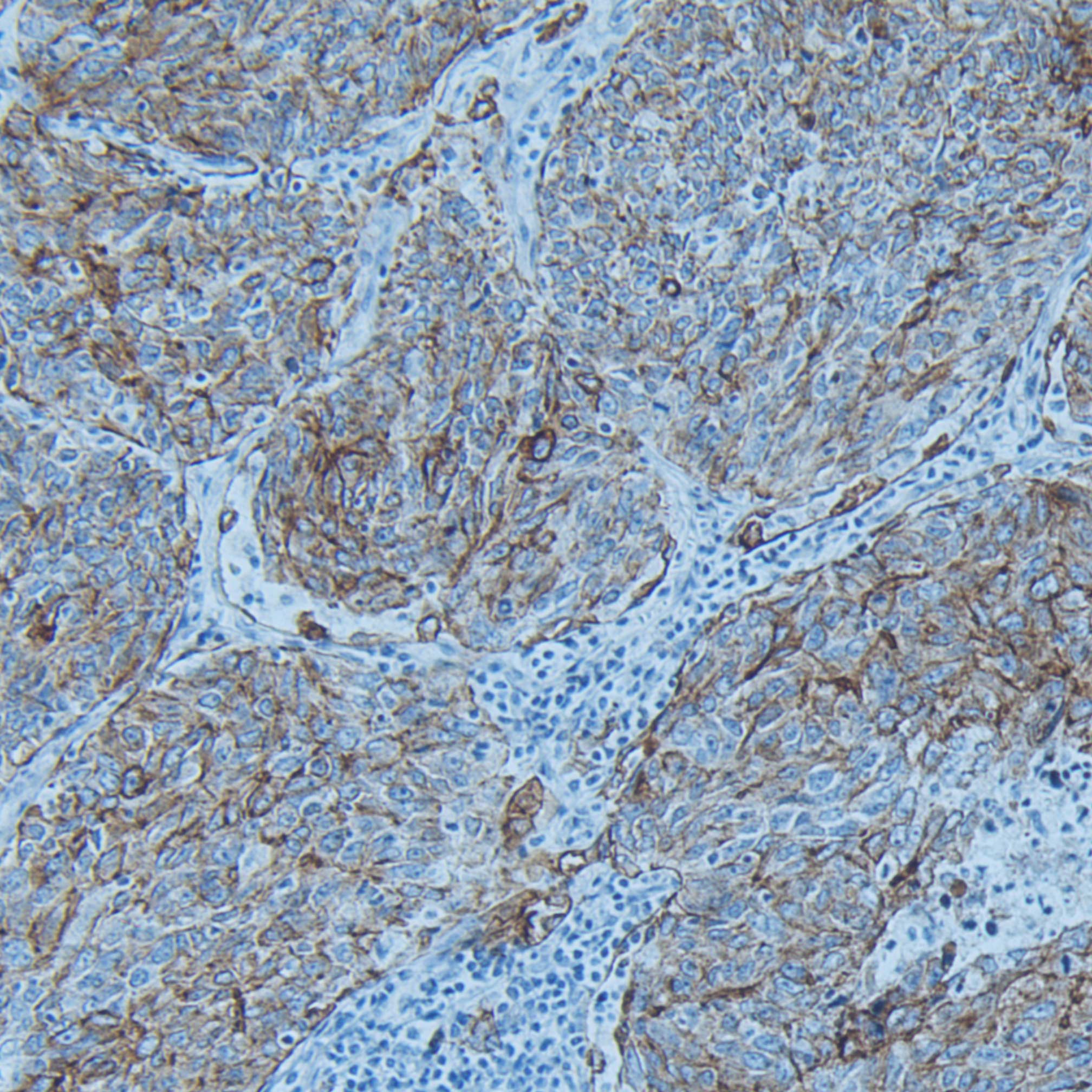 小鼠抗CK18单克隆抗体,Anti-CK18 mouse monoclonal antibody 生命科学产品与技术服务-生工生物工程(上海 ...