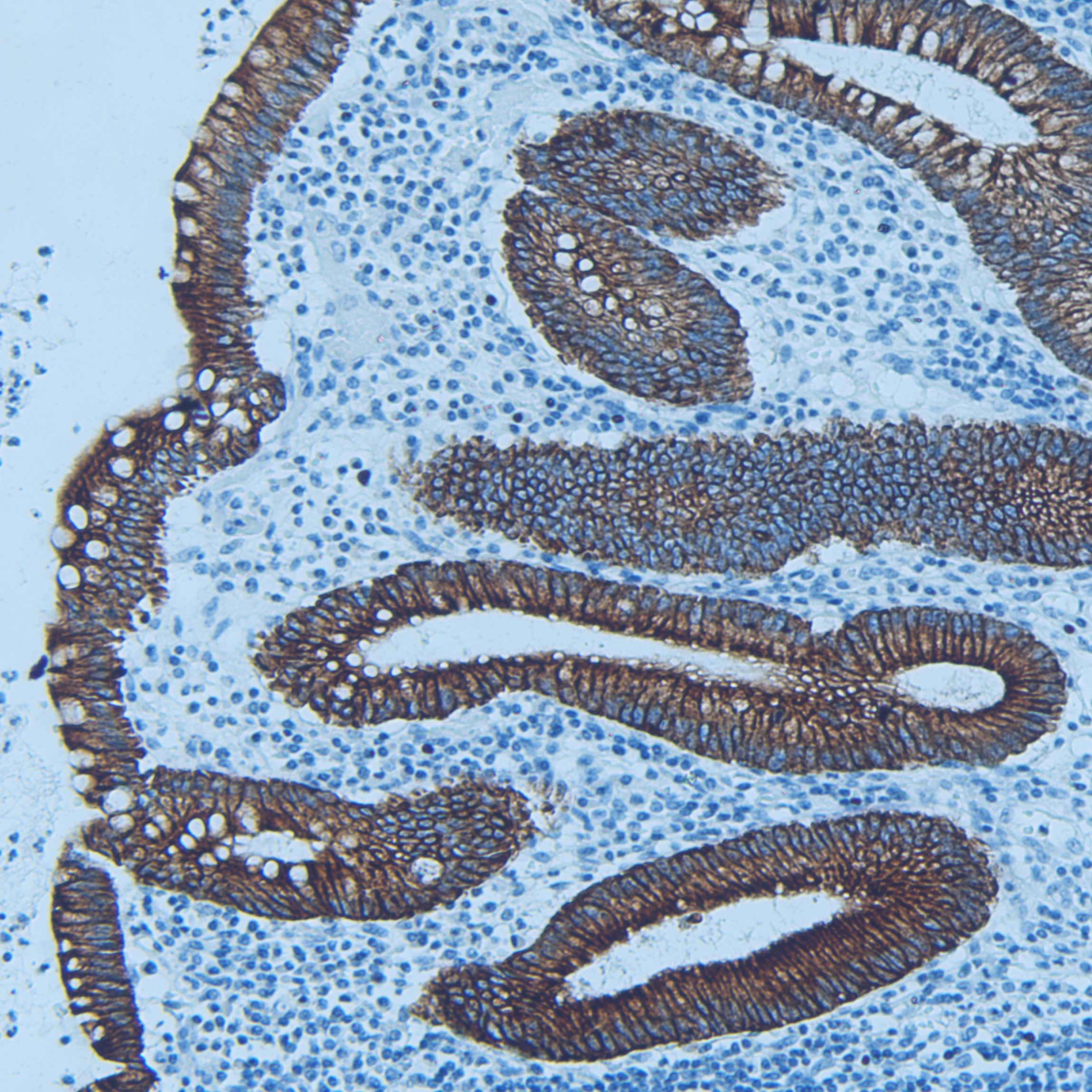 小鼠抗CK18单克隆抗体,Anti-CK18 mouse monoclonal antibody 生命科学产品与技术服务-生工生物工程(上海 ...