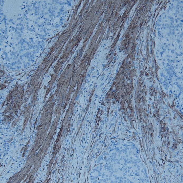 小鼠抗SMA单克隆抗体,Anti-SMA mouse monoclonal antibody 生命科学产品与技术服务-生工生物工程(上海)股份有限公司