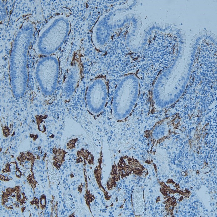 小鼠抗SMA单克隆抗体,Anti-SMA mouse monoclonal antibody 生命科学产品与技术服务-生工生物工程(上海)股份有限公司