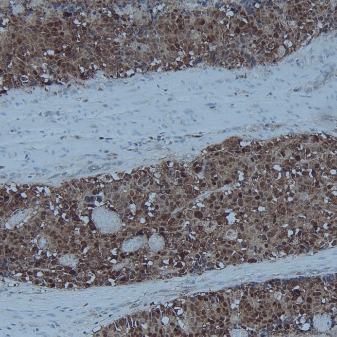 小鼠抗gst π单克隆抗体anti Gst π Mouse Monoclonal Antibody 生命科学产品与技术服务 生工生物工程