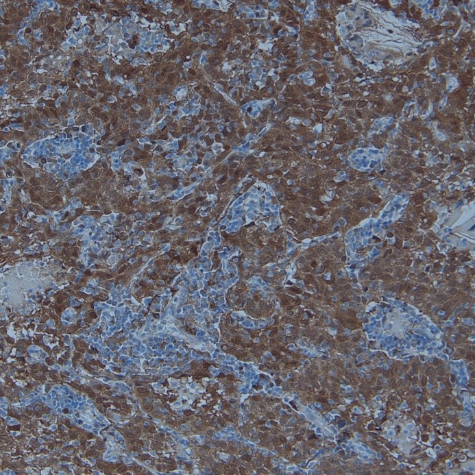 小鼠抗gst π单克隆抗体anti Gst π Mouse Monoclonal Antibody 生命科学产品与技术服务 生工生物工程