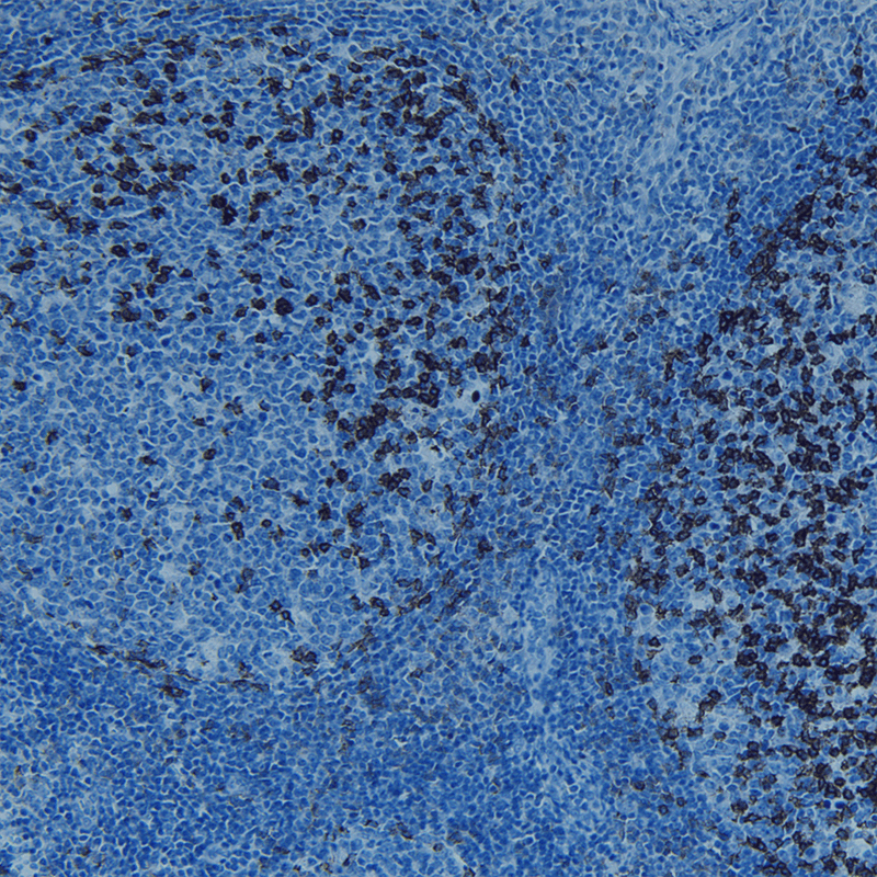 小鼠抗PD-1单克隆抗体,Anti-PD-1 mouse monoclonal antibody 生命科学产品与技术服务-生工生物工程(上海 ...