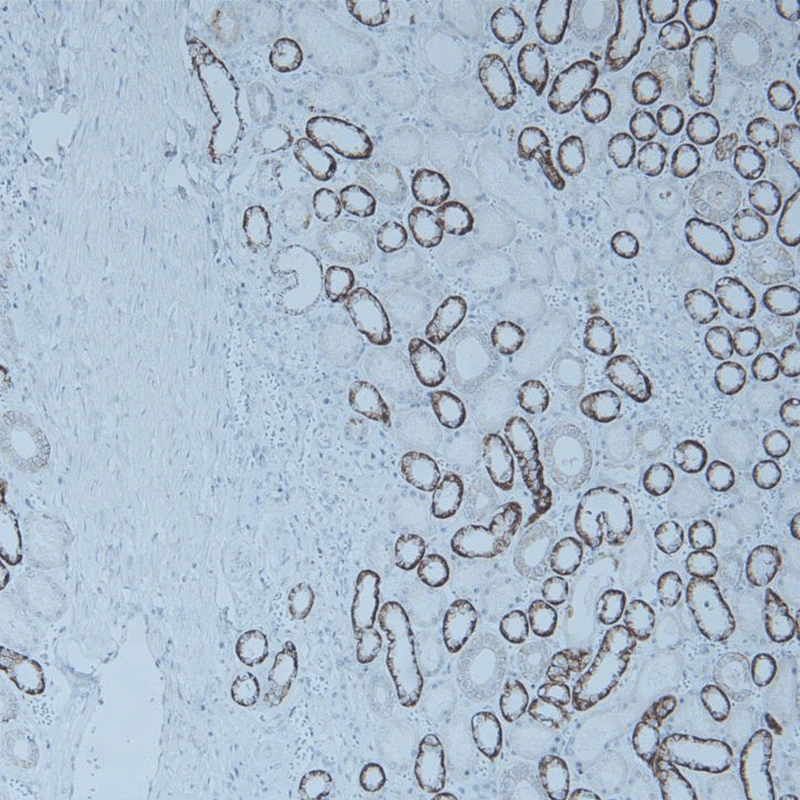 小鼠抗Ksp-Cadherin单克隆抗体,Anti-Ksp-Cadherin mouse monoclonal antibody 生命科学产品 ...