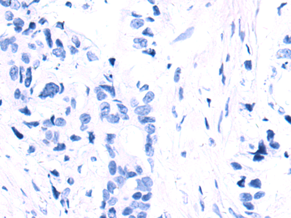 兔抗STAT1多克隆抗体,Anti-STAT1 rabbit polyclonal antibody 生命科学产品与技术服务-生工生物工程 ...