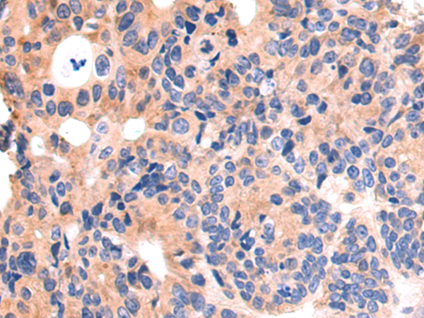 兔抗STAT1多克隆抗体,Anti-STAT1 rabbit polyclonal antibody 生命科学产品与技术服务-生工生物工程 ...