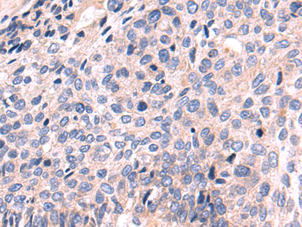 兔抗STAT1多克隆抗体,Anti-STAT1 rabbit polyclonal antibody 生命科学产品与技术服务-生工生物工程 ...