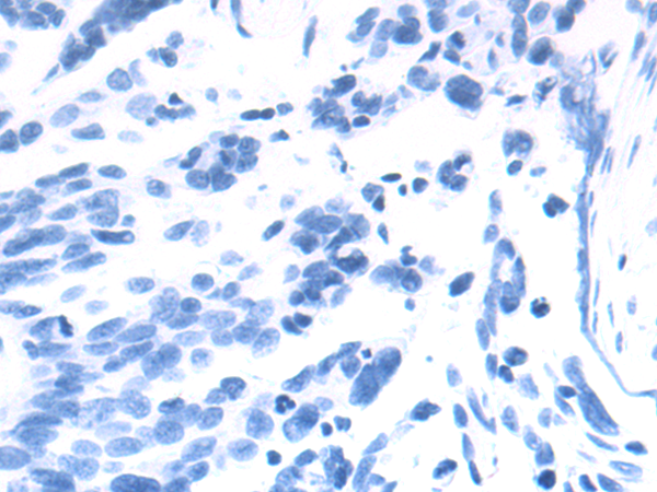 兔抗FTL多克隆抗体,Anti-FTL rabbit polyclonal antibody 生命科学产品与技术服务-生工生物工程(上海)股份有限公司
