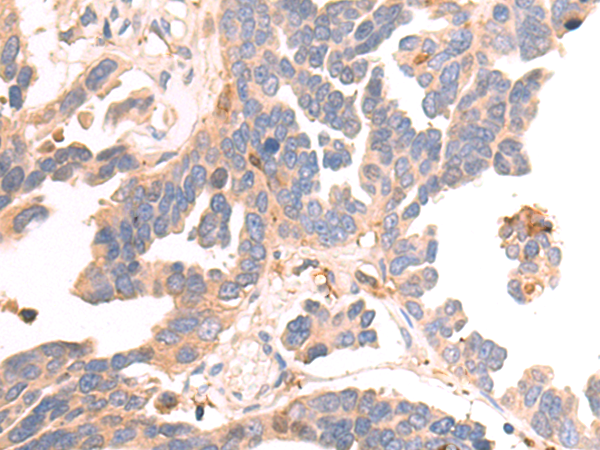 兔抗FTL多克隆抗体,Anti-FTL rabbit polyclonal antibody 生命科学产品与技术服务-生工生物工程(上海)股份有限公司