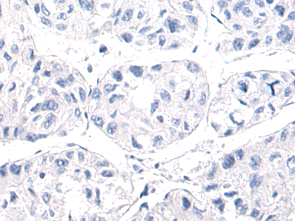 兔抗ACLY多克隆抗体,Anti-ACLY rabbit polyclonal antibody 生命科学产品与技术服务-生工生物工程(上海 ...