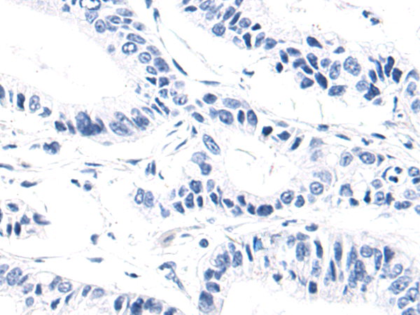 兔抗ACLY多克隆抗体,Anti-ACLY rabbit polyclonal antibody 生命科学产品与技术服务-生工生物工程(上海 ...