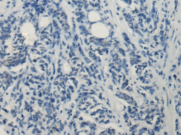 兔抗PDHB多克隆抗体,Anti-PDHB rabbit polyclonal antibody 生命科学产品与技术服务-生工生物工程(上海 ...