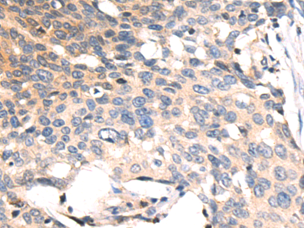 兔抗GCLC多克隆抗体,Anti-GCLC rabbit polyclonal antibody 生命科学产品与技术服务-生工生物工程(上海)股份有限公司