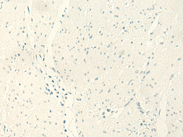 兔抗TMEM9多克隆抗体,Anti-TMEM9 rabbit polyclonal antibody 生命科学产品与技术服务-生工生物工程 ...
