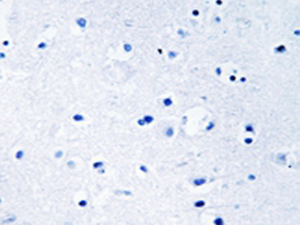 兔抗REXO1多克隆抗体,Anti-REXO1 rabbit polyclonal antibody 生命科学产品与技术服务-生工生物工程 ...