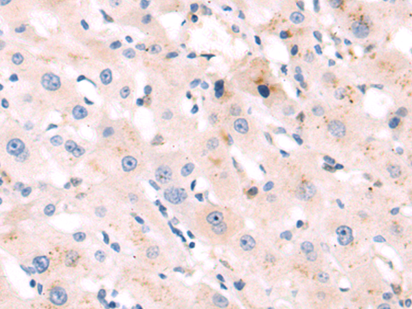 兔抗NECTIN1多克隆抗体,Anti-NECTIN1 rabbit polyclonal antibody 生命科学产品与技术服务-生工生物 ...