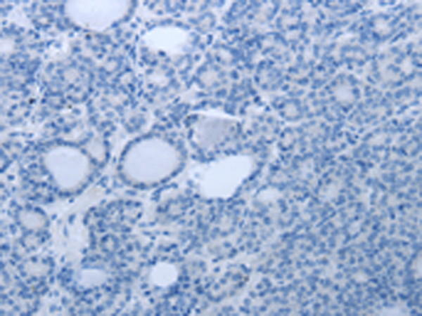 兔抗pparg多克隆抗体anti Pparg Rabbit Polyclonal Antibody 生命科学产品与技术服务 生工生物工程