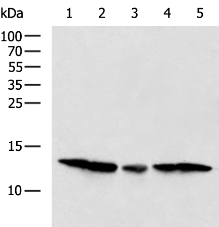 兔抗TXN多克隆抗体,Anti-TXN rabbit polyclonal antibody 生命科学产品与技术服务-生工生物工程(上海)股份有限公司