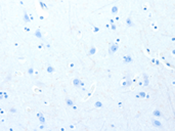 兔抗AARS1多克隆抗体,Anti-AARS1 rabbit polyclonal antibody 生命科学产品与技术服务-生工生物工程 ...