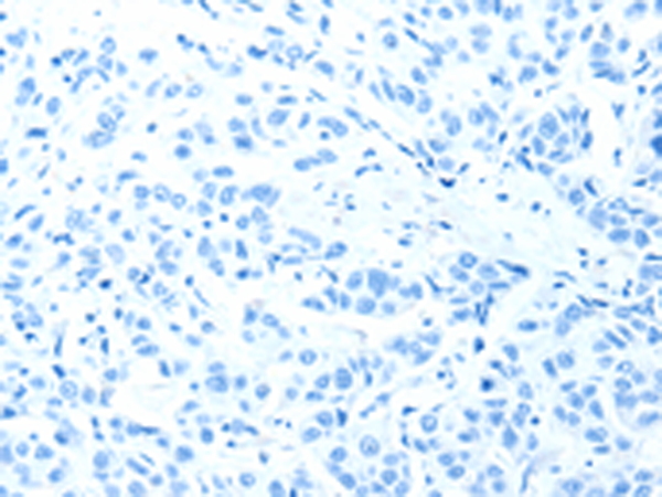 兔抗AARS1多克隆抗体,Anti-AARS1 rabbit polyclonal antibody 生命科学产品与技术服务-生工生物工程 ...