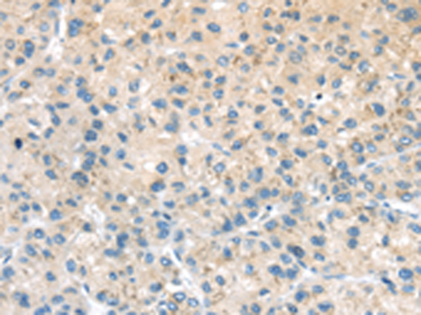 兔抗ADRB3多克隆抗体,Anti-ADRB3 rabbit polyclonal antibody 生命科学产品与技术服务-生工生物工程 ...