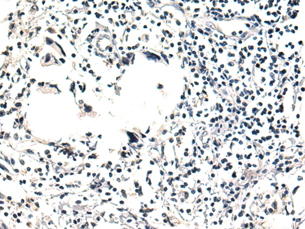 兔抗mycn多克隆抗体anti Mycn Rabbit Polyclonal Antibody 生命科学产品与技术服务 生工生物工程上海