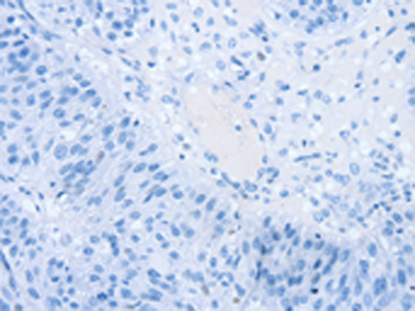 兔抗SSB多克隆抗体,Anti-SSB rabbit polyclonal antibody 生命科学产品与技术服务-生工生物工程(上海)股份有限公司