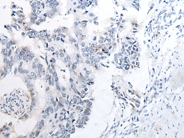 兔抗knl1多克隆抗体anti Knl1 Rabbit Polyclonal Antibody 生命科学产品与技术服务 生工生物工程上海