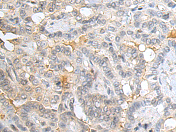 小鼠抗MICU1单克隆抗体,Anti-MICU1 mouse monoclonal antibody 生命科学产品与技术服务-生工生物工程 ...