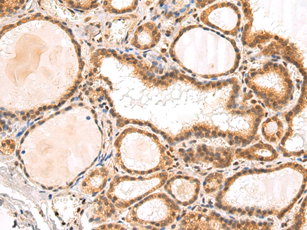 小鼠抗STAT3单克隆抗体,Anti-STAT3 mouse monoclonal antibody 生命科学产品与技术服务-生工生物工程 ...