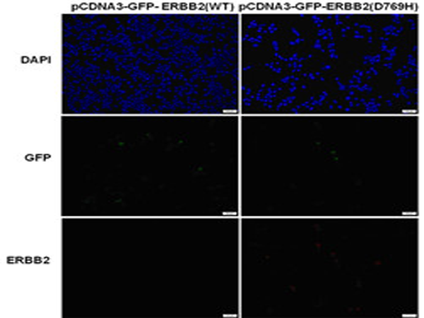 小鼠抗ERBB2 (mutated D769H)单克隆抗体,Anti-ERBB2 (mutated D769H) mouse monoclonal antibody 生命科学产品与技术服务-生 ...