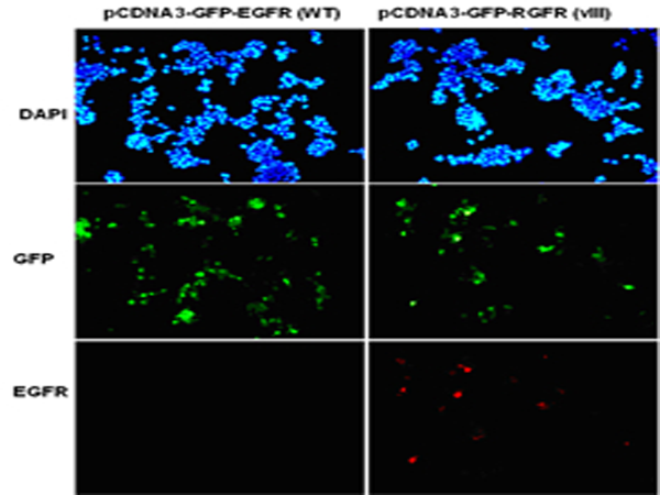 小鼠抗EGFR (vIII mutation)单克隆抗体,Anti-EGFR (vIII mutation) mouse monoclonal ...