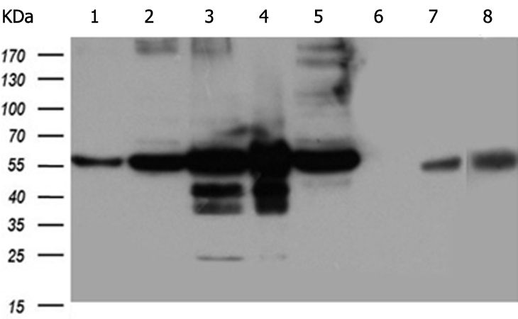小鼠抗IRF3单克隆抗体,Anti-IRF3 mouse monoclonal antibody 生命科学产品与技术服务-生工生物工程(上海)股份有限公司