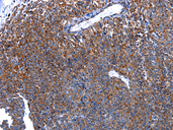 兔抗HSPD1多克隆抗体,Anti-HSPD1 rabbit polyclonal antibody 生命科学产品与技术服务-生工生物工程 ...