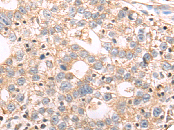 兔抗LGR5多克隆抗体,Anti-LGR5 rabbit polyclonal antibody 生命科学产品与技术服务-生工生物工程(上海 ...