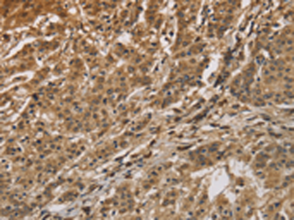 兔抗calu多克隆抗体anti Calu Rabbit Polyclonal Antibody 生命科学产品与技术服务 生工生物工程上海