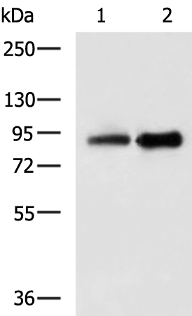 兔抗APP多克隆抗体,Anti-APP rabbit polyclonal antibody 生命科学产品与技术服务-生工生物工程(上海)股份有限公司