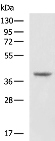 兔抗TRIM63多克隆抗体,Anti-TRIM63 rabbit polyclonal antibody 生命科学产品与技术服务-生工生物工程 ...
