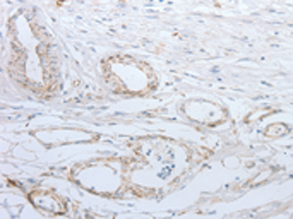 兔抗SLC5A5多克隆抗体,Anti-SLC5A5 rabbit polyclonal antibody 生命科学产品与技术服务-生工生物工程 ...