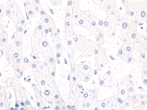兔抗IBSP多克隆抗体,Anti-IBSP rabbit polyclonal antibody 生命科学产品与技术服务-生工生物工程(上海 ...