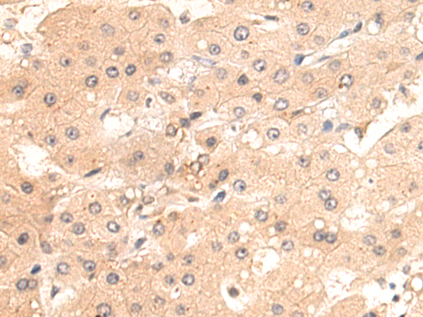兔抗IBSP多克隆抗体,Anti-IBSP rabbit polyclonal antibody 生命科学产品与技术服务-生工生物工程(上海 ...