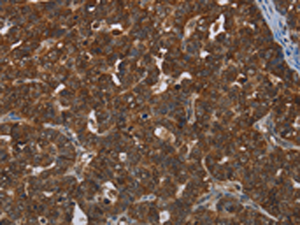 兔抗CERS5多克隆抗体,Anti-CERS5 rabbit polyclonal antibody 生命科学产品与技术服务-生工生物工程 ...