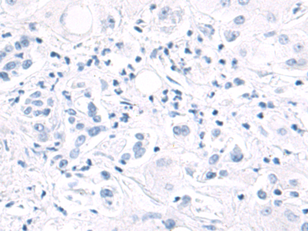 兔抗PRKN多克隆抗体,Anti-PRKN rabbit polyclonal antibody 生命科学产品与技术服务-生工生物工程(上海 ...