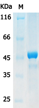 新冠病毒 S1重组蛋白,SARS-CoV-2 S1 Recombinant protein 生命科学产品与技术服务-生工生物工程(上海)股份有限公司