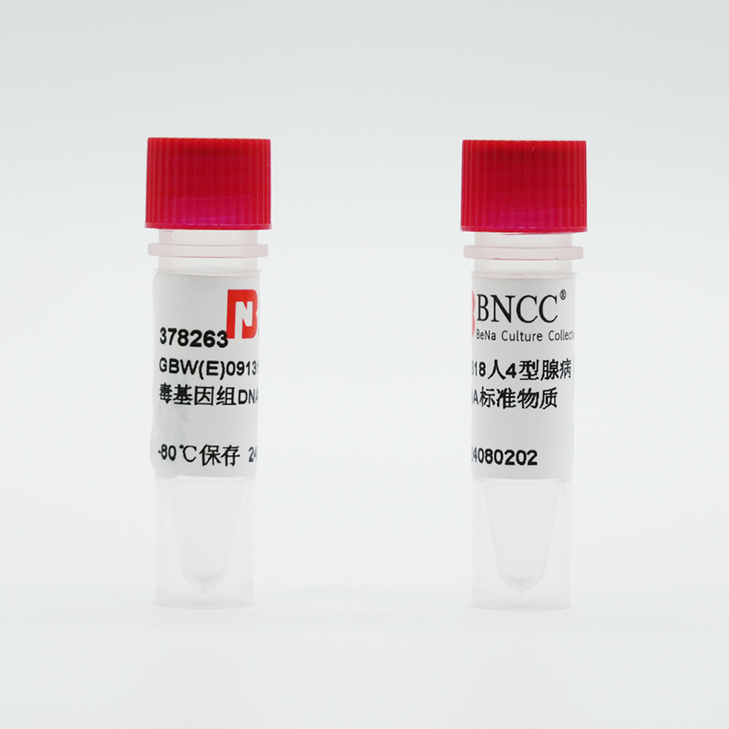 铜绿假单胞菌基因组DNA,Genomic DNA from Pseudomonas aeruginosa (Schroeter) Migula ...