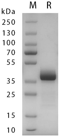人IL6重组蛋白（10×His tag and SUMO tag N-Terminus）,Human IL6 Recombinant ...