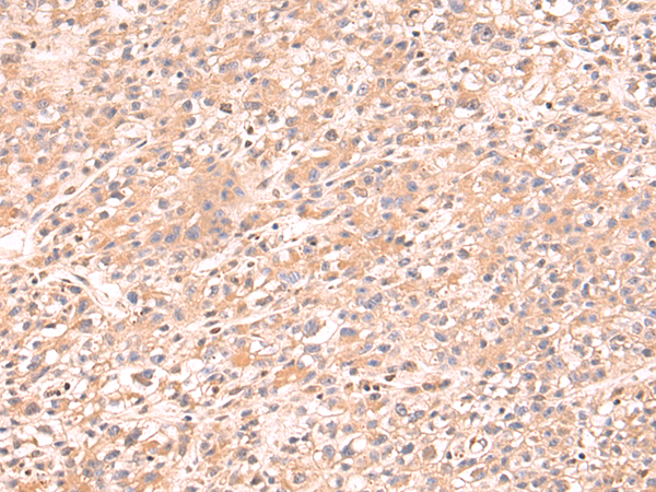 兔抗AFP多克隆抗体,Anti-AFP rabbit polyclonal antibody 生命科学产品与技术服务-生工生物工程(上海)股份有限公司