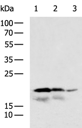 兔抗BAX多克隆抗体,Anti-BAX rabbit polyclonal antibody 生命科学产品与技术服务-生工生物工程(上海)股份有限公司