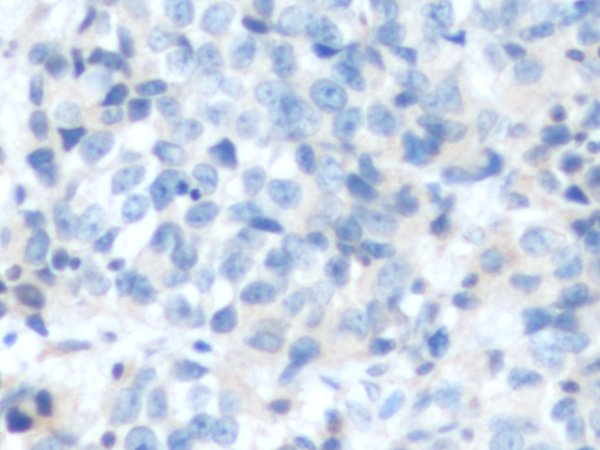 兔抗mmp9多克隆抗体anti Mmp9 Rabbit Polyclonal Antibody 生命科学产品与技术服务 生工生物工程上海