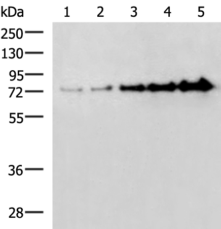 兔抗BSA多克隆抗体,Anti-BSA rabbit polyclonal antibody 生命科学产品与技术服务-生工生物工程(上海)股份有限公司